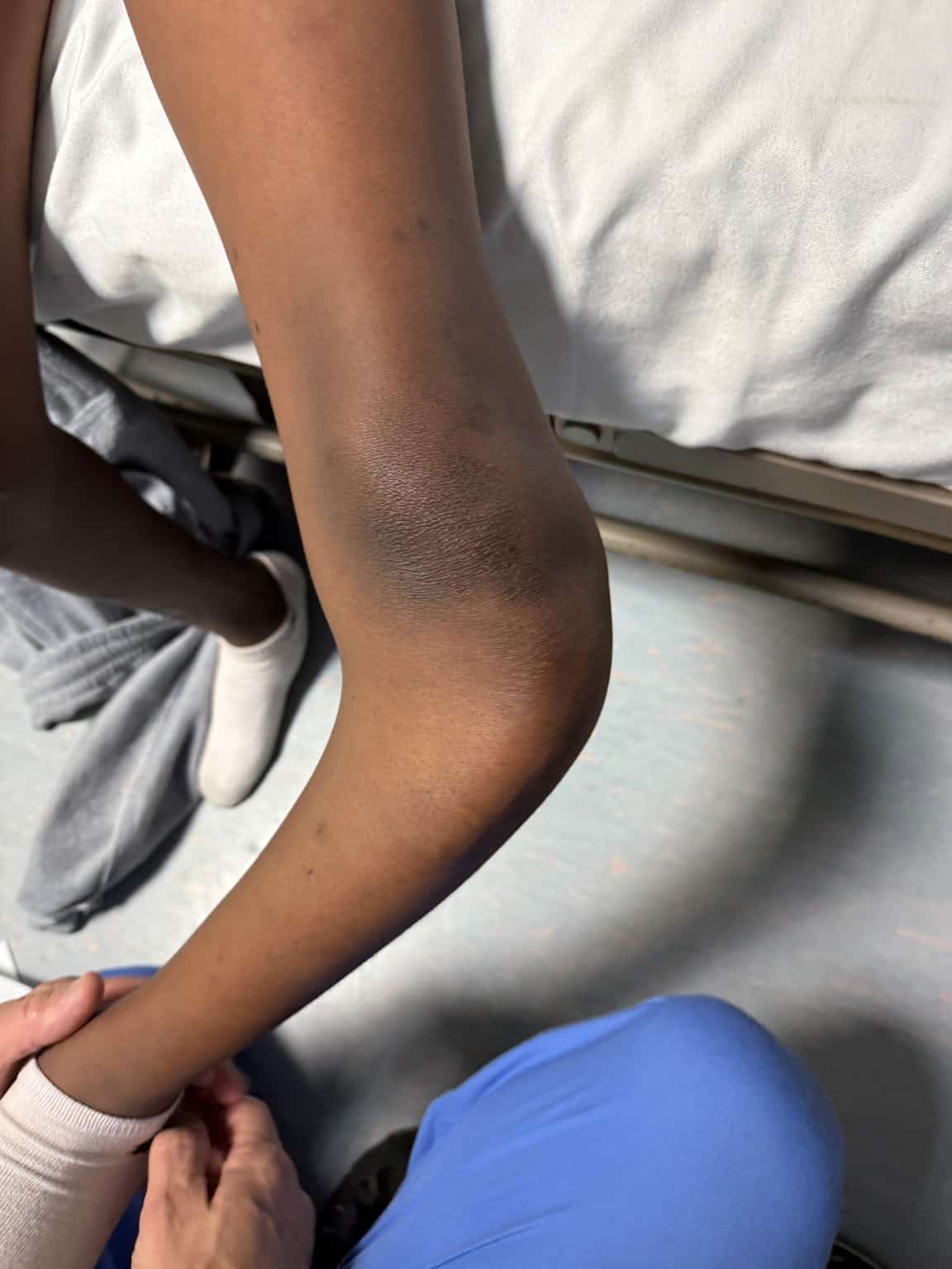 St. Luke’s Chairman of Orthopedic Surgery Shares His Expertise in ...